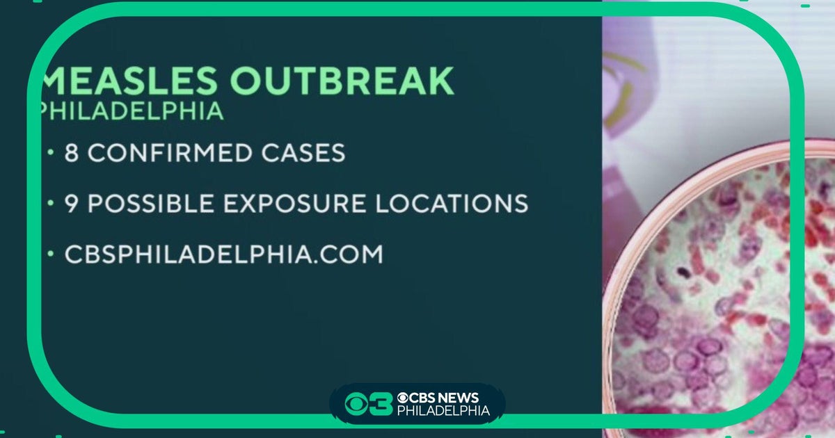 Philadelphia Health Department confirms 2 more measles cases - CBS ...