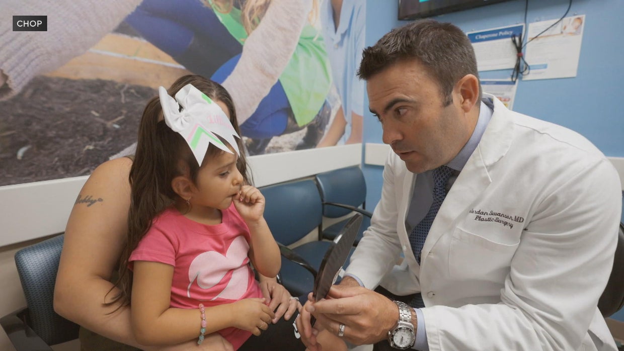 Doctors at CHOP use new kind of reconstructive surgery to give girl a ...