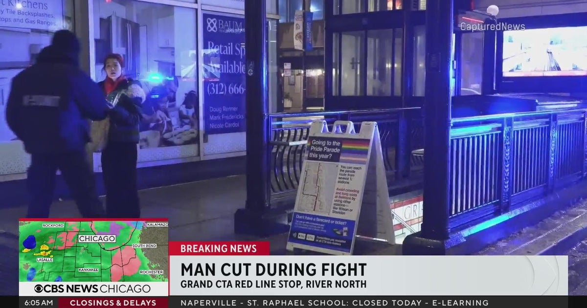 Man cut during fight on Chicago train - CBS Chicago