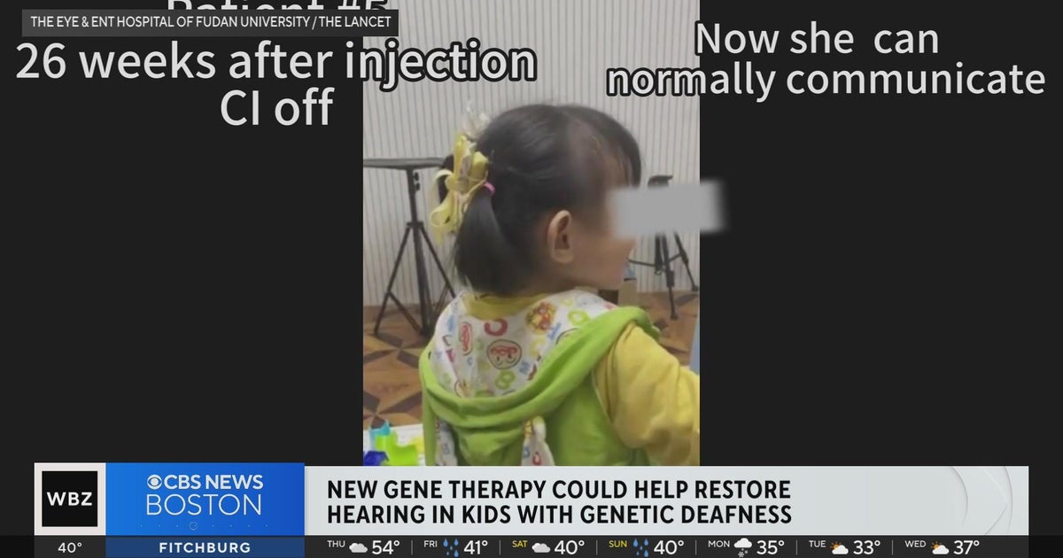 Gene therapy, researched by Mass Eye and Ear, could restore hearing in ...
