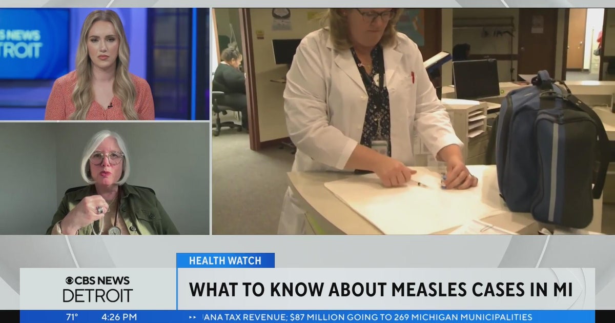 What to know about measles cases in Michigan - CBS Detroit