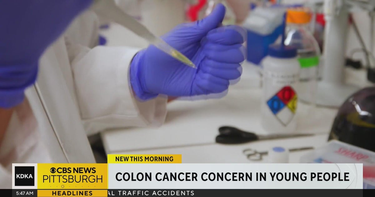 Colon cancer concern in young people - CBS Pittsburgh