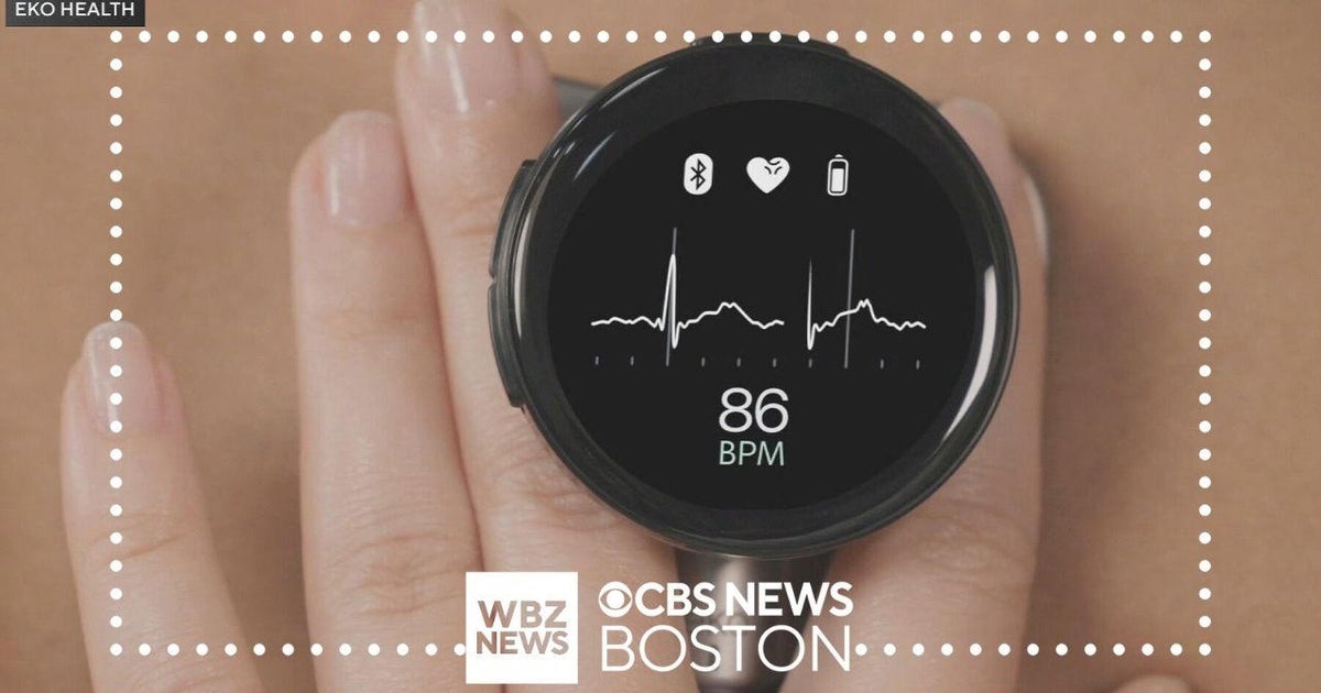 New stethoscope uses AI to help doctors find heart valve problems - CBS ...