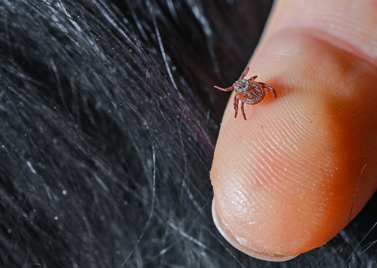 What do ticks look like? How to spot and get rid of them, according to experts - CBS News