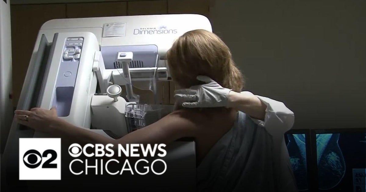 New breast cancer screening guidelines - CBS Chicago