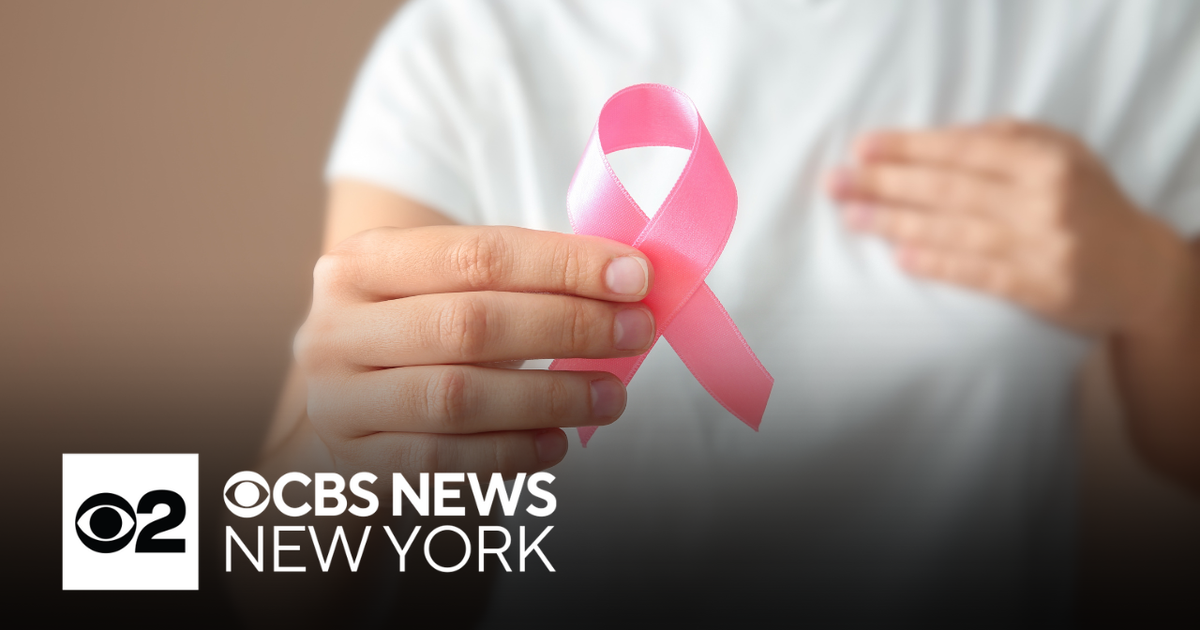 New breast cancer screening guidelines recommend starting at age 40 ...