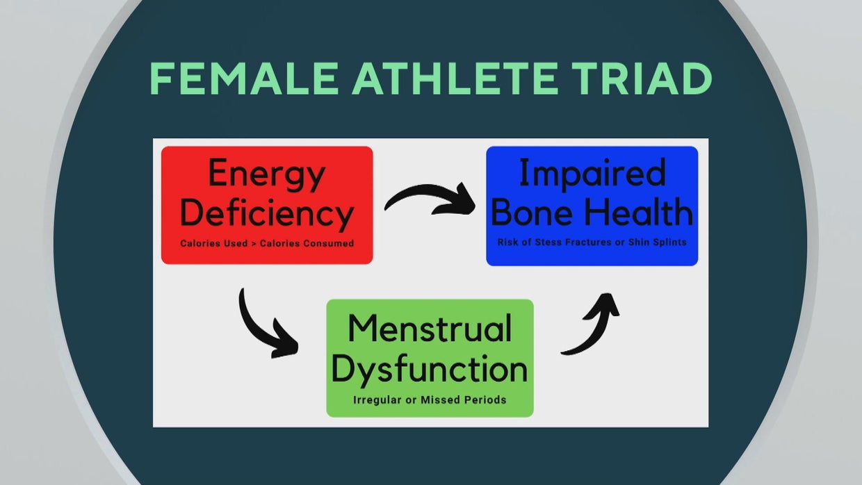 What is female athlete triad? Here's what to know about the often ...