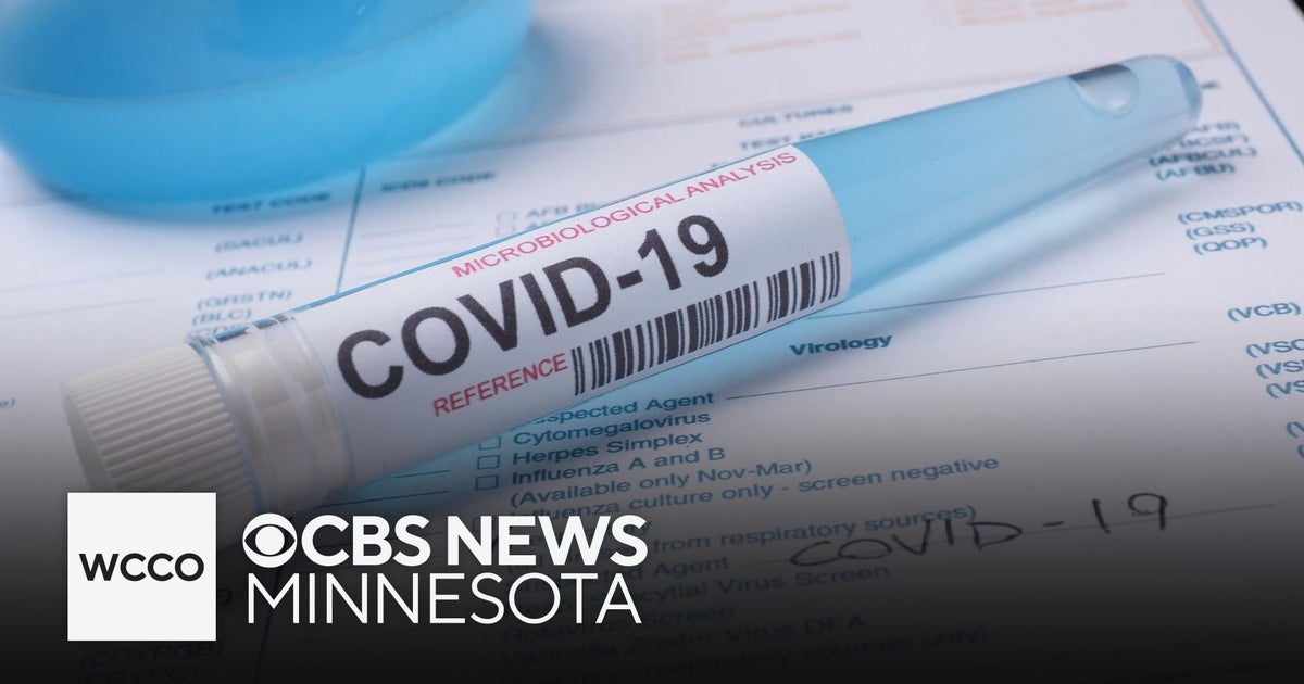 Minnesota sees 1.8 million COVID-19 cases through May 2023, CDC says ...