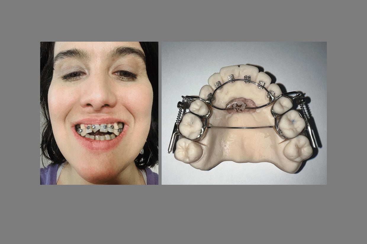 FDA said it "never" inspected dental lab that made controversial AGGA ...