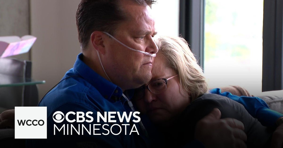 Retired firefighter makes big strides in transplant journey - CBS Minnesota