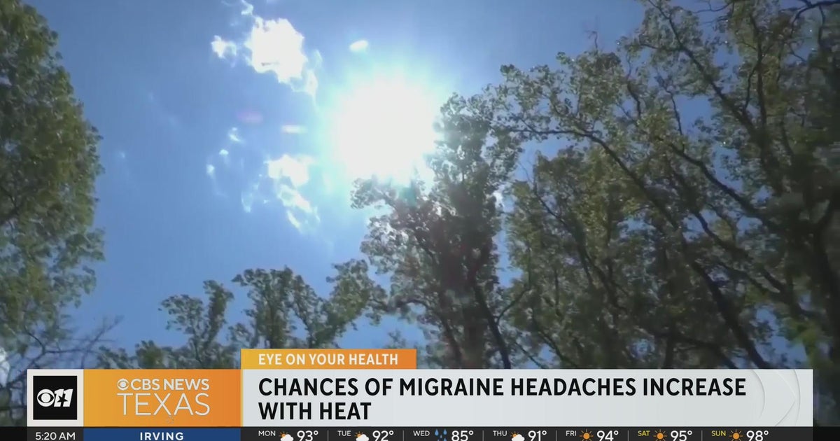 Chances of migraine headaches increase with heat: Study - CBS Texas