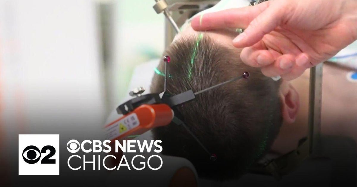 Boy becomes first person fitted with brain implant to control epileptic ...