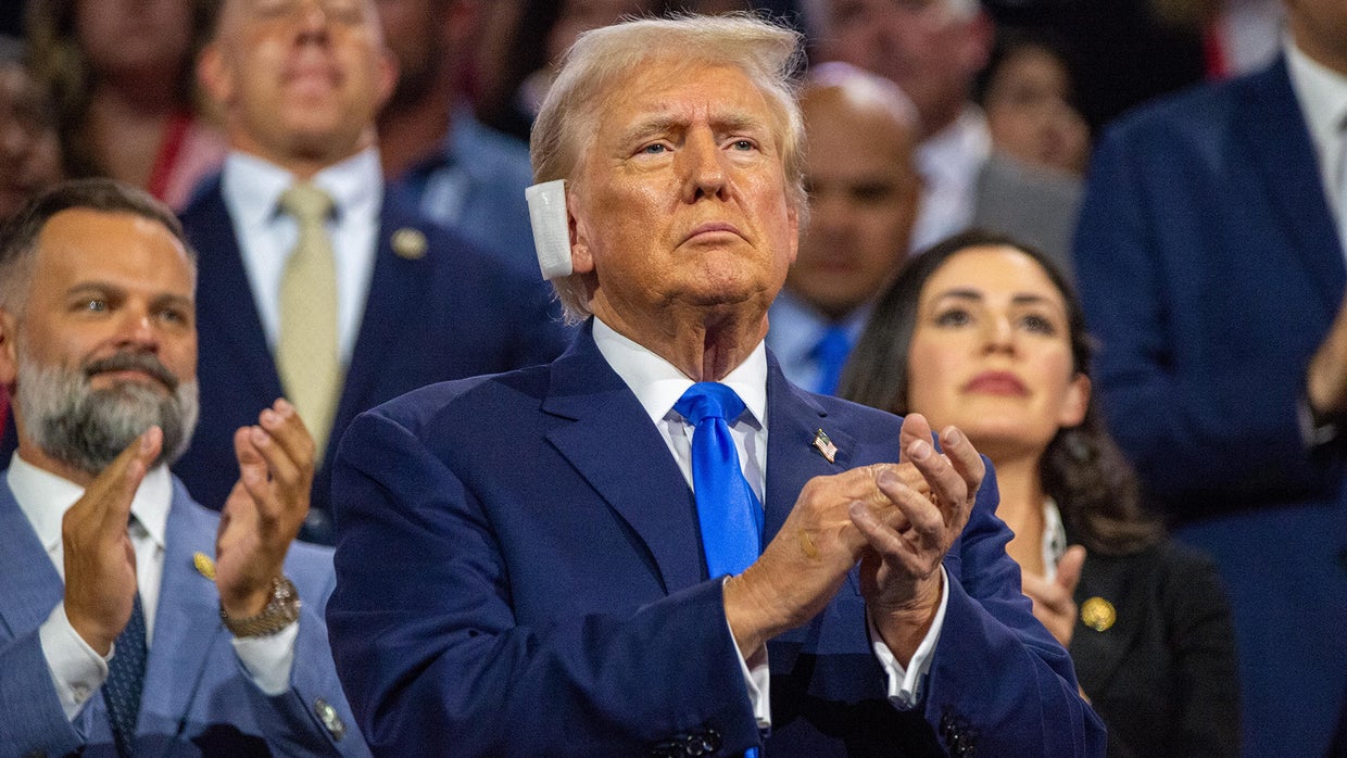 Donald Trump doesn't have stitches after assassination attempt, but a ...