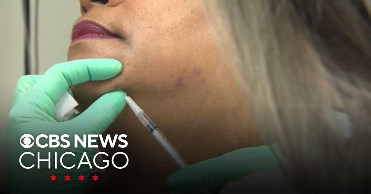 More patients traveling to Chicago for cosmetic procedures - CBS Chicago