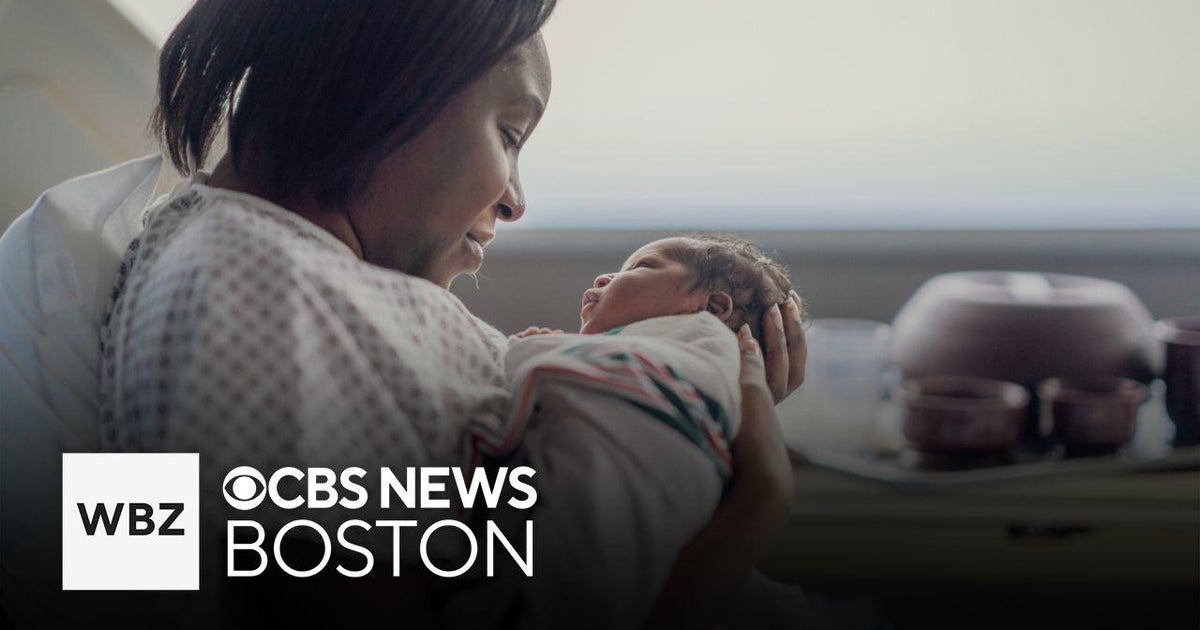 Study finds doctor are more to likely to give unnecessary c-sections to Black mothers - CBS Boston