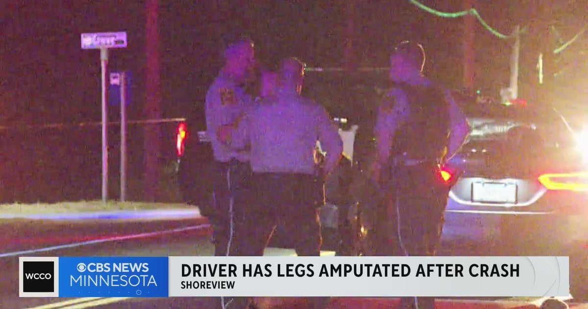 Man loses legs in Shoreview crash early Sunday - CBS Minnesota