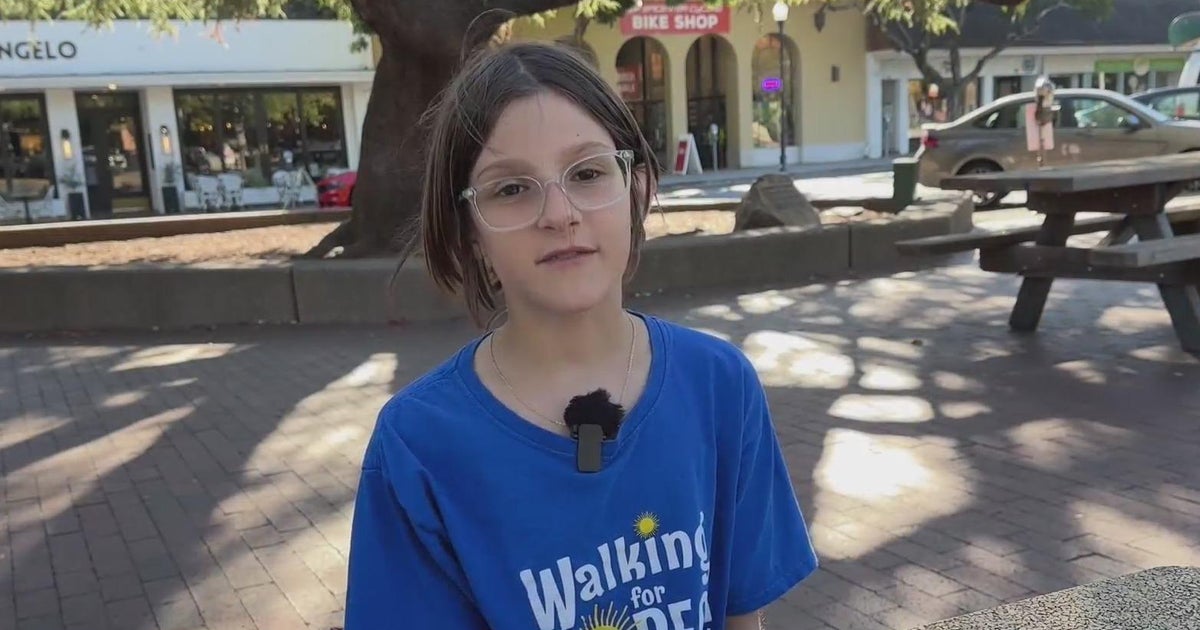 Bay Area girl using her own struggle with alopecia to bring joy and ...