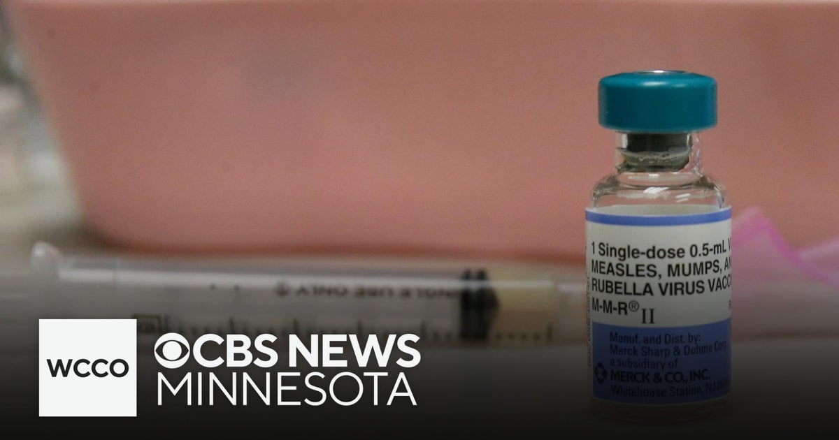 Minnesota Department of Health looks to get a handle on measles ...