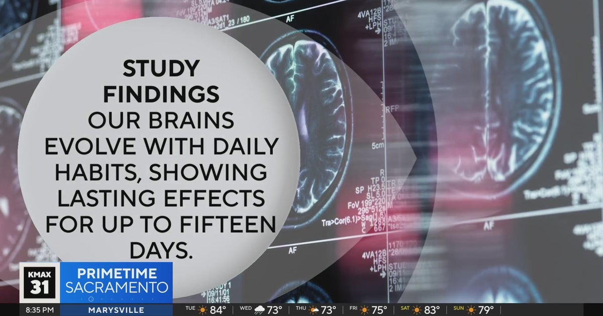 How do daily activities affect the brain? | The Answer - CBS Sacramento