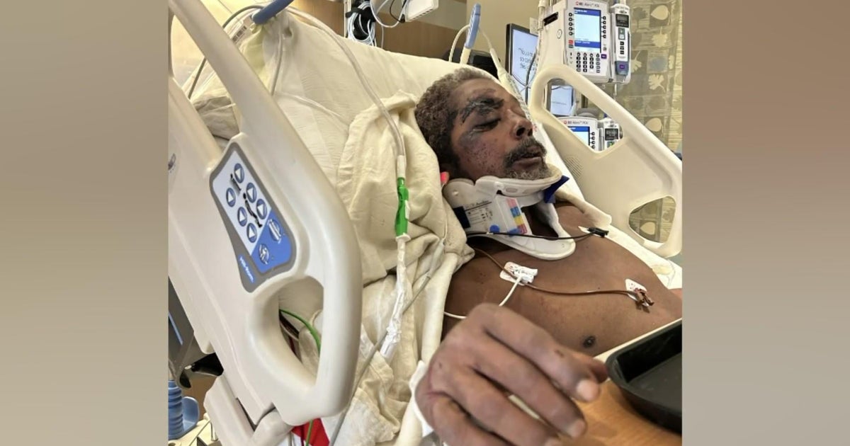 Aurora father hospitalized after weekend hit-and-run crash - CBS Colorado