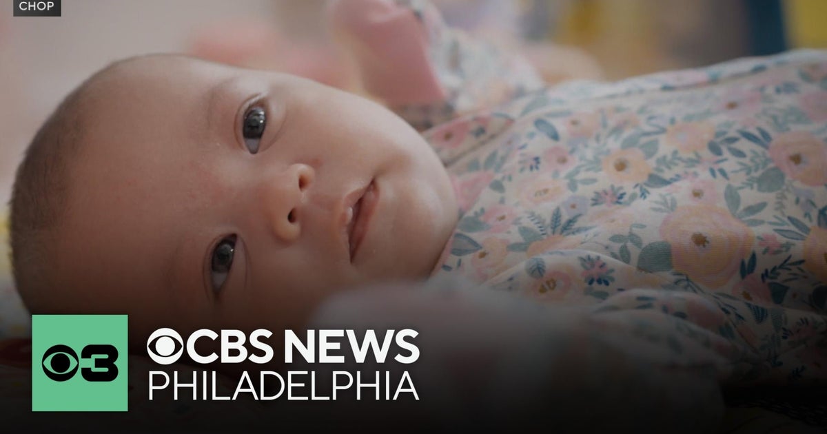 Philadelphia doctors successfully remove deadly tumor from fetus - CBS ...