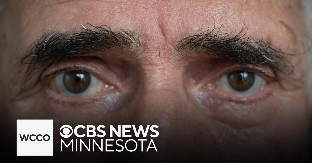 Why does our vision get worse as we age? - CBS Minnesota