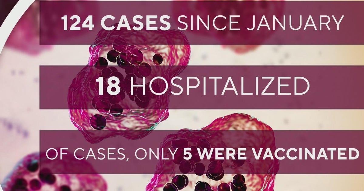 Texas measles outbreak now over 120 cases, DSHS reports - CBS Texas