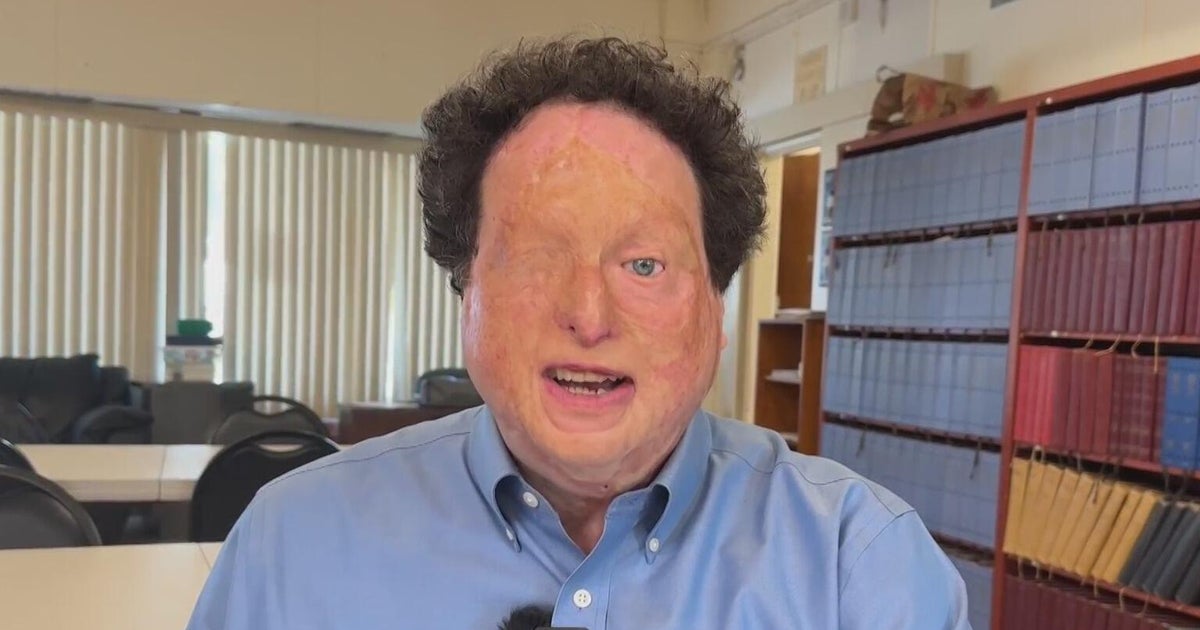Blind Berkeley inventor creates tools to help the sight impaired - CBS ...