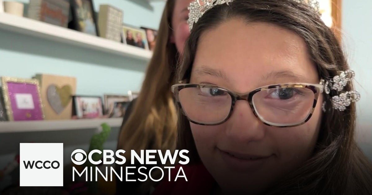 Minnesota woman is only known person with unnamed genetic disorder ...