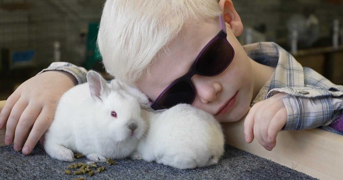 Texas boy with cancer raises award-winning rabbits - CBS News