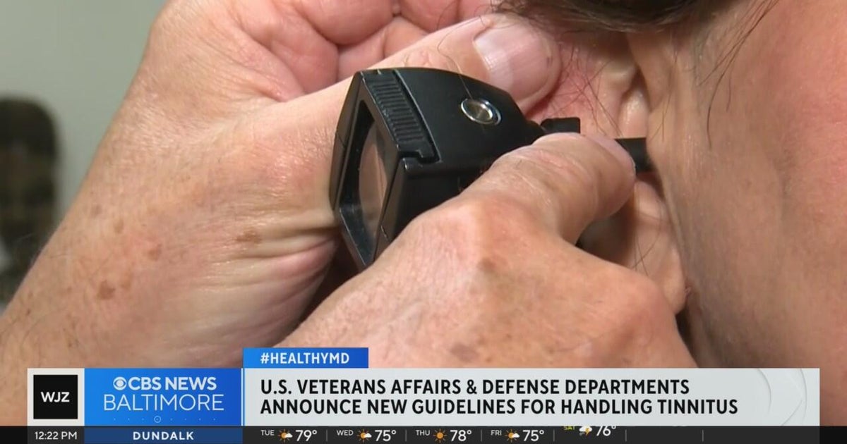 U.S. Veterans Affairs and Defense Departments share new guidelines for ...