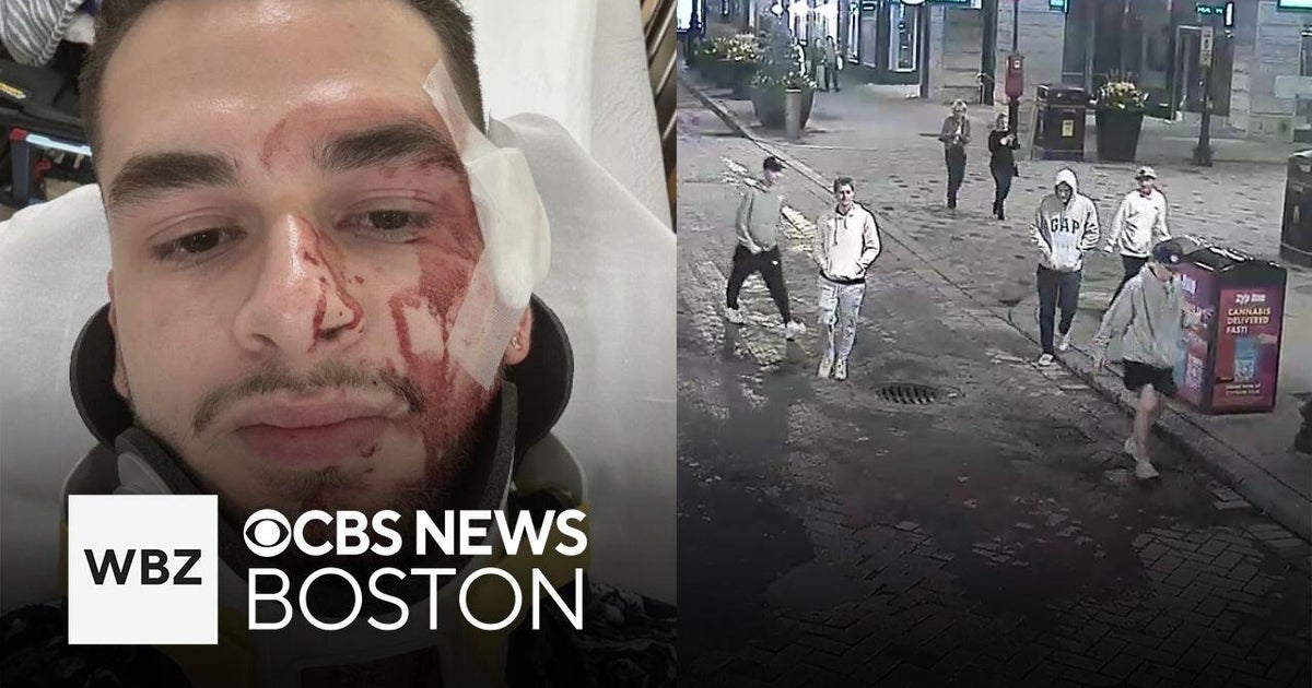 Suffolk University student says group of men smashed beer bottle on his ...