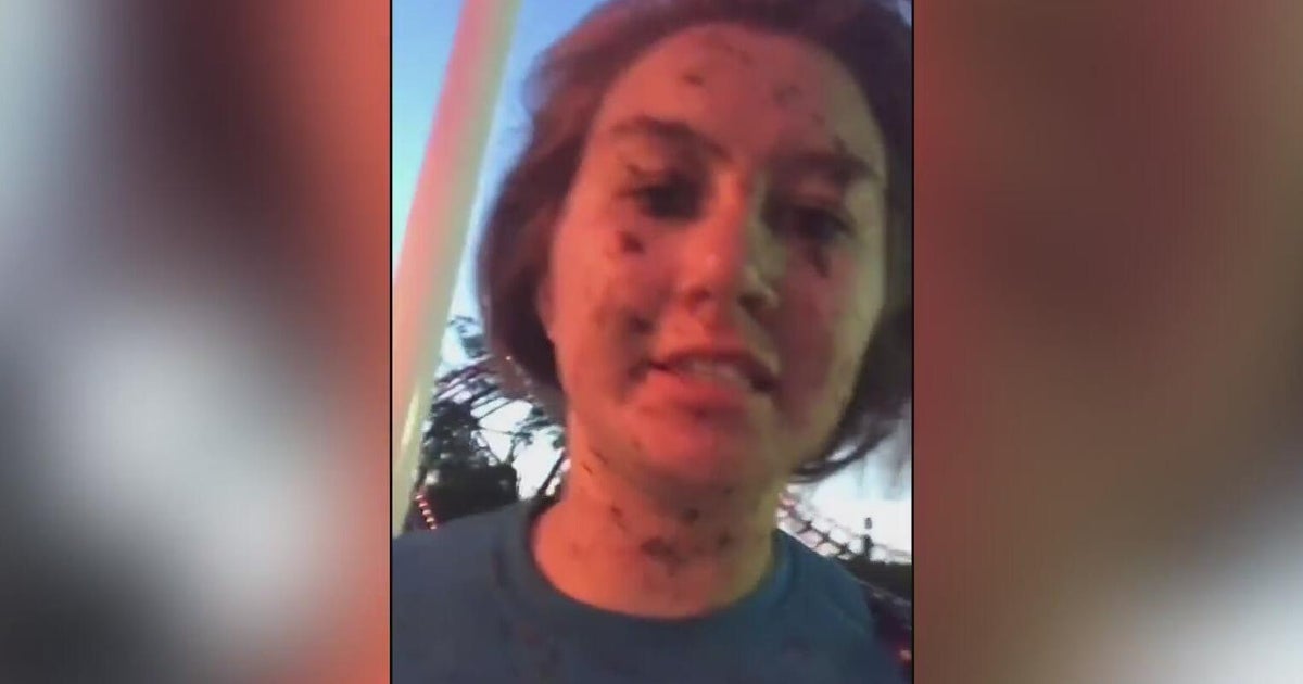 Woman hit with fish flies while riding roller coaster at Cedar Point ...