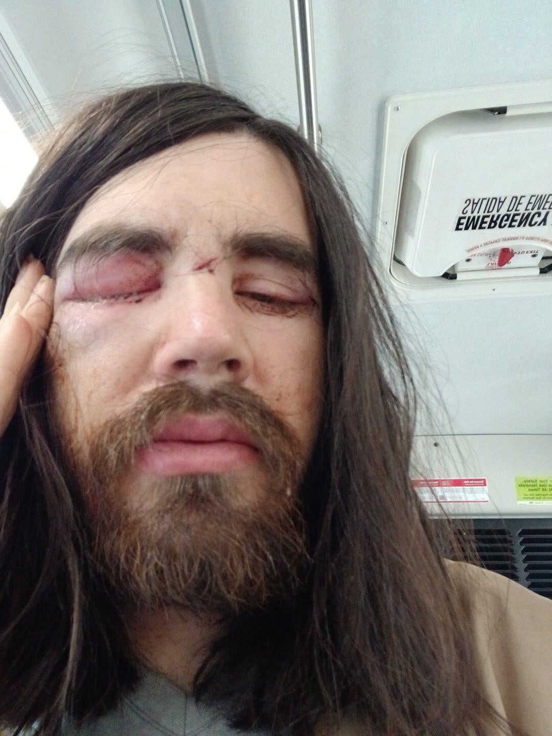 After chain attack in Boulder, Colorado, victim's mother shares ...