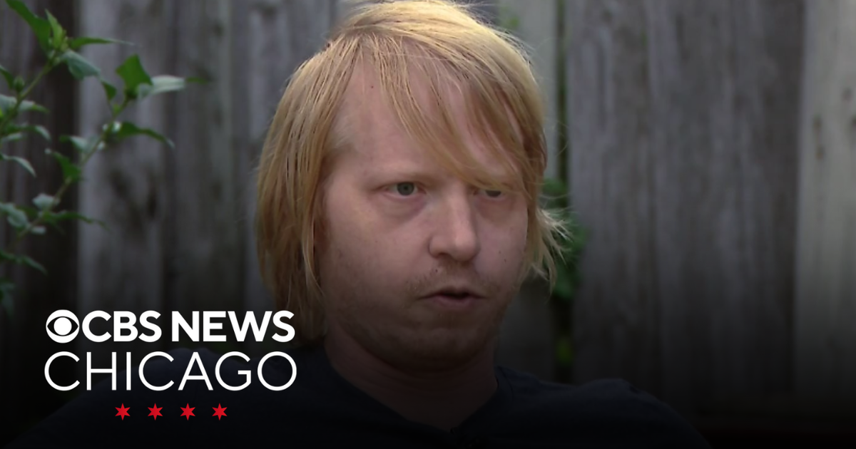 Man speaks out after being shot during armed robbery in Chicago's ...