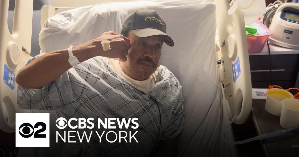 Random NYC subway station attack leaves victim with broken jaw - CBS ...