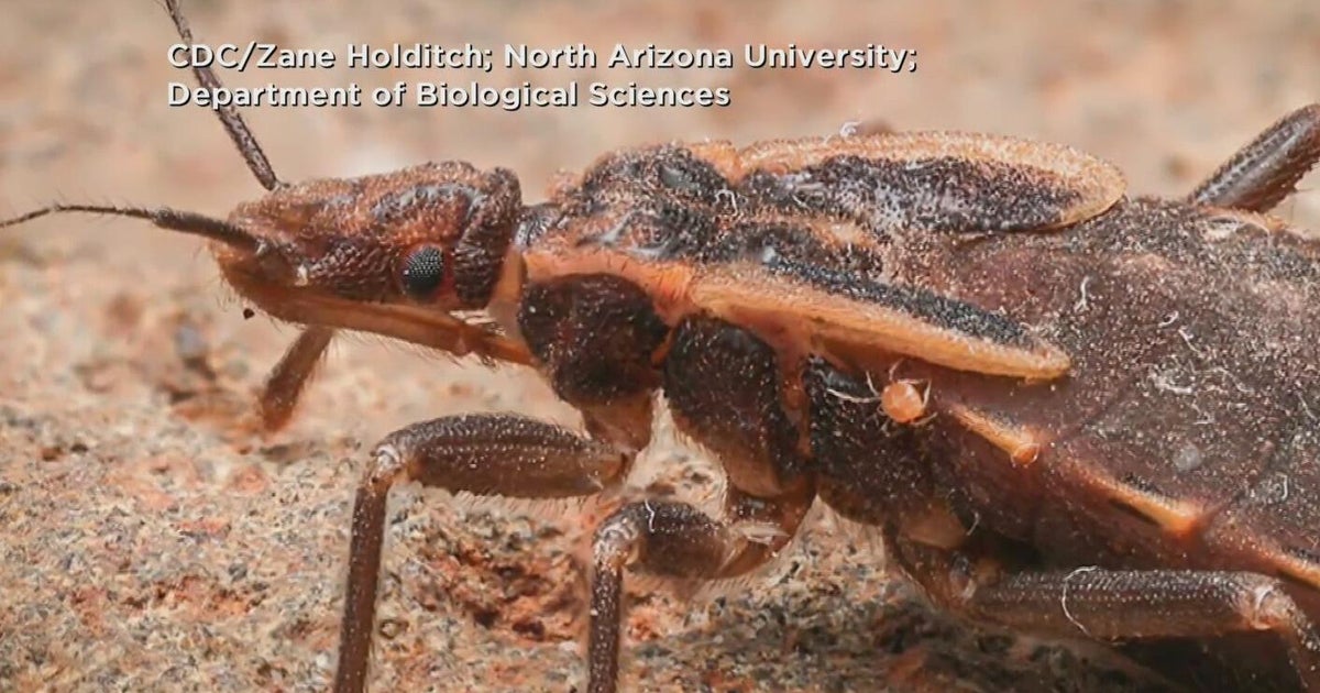 Human cases of "kissing bug" disease reported in several states - CBS Texas