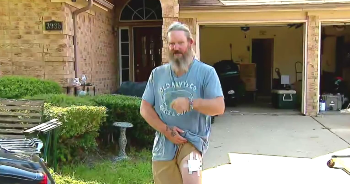 Grand Prairie man details being shot by police after 911 error sent ...