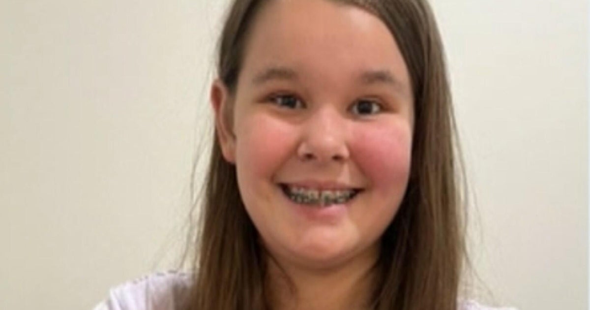 Wednesday's Child: 12-year-old Skylar - CBS Boston