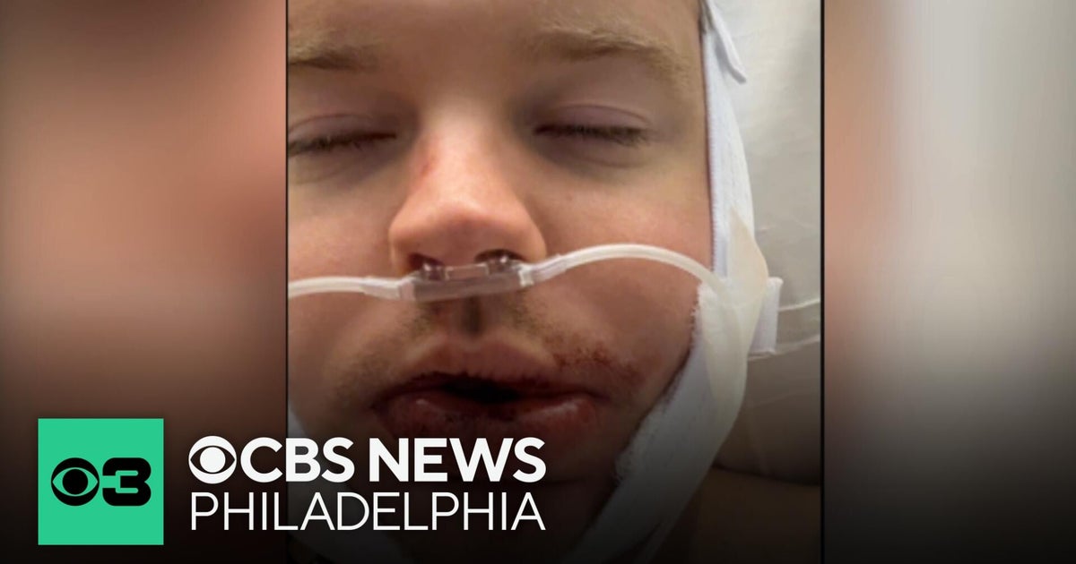Suspect wanted after random attack leaves victim badly injured: "It was ...