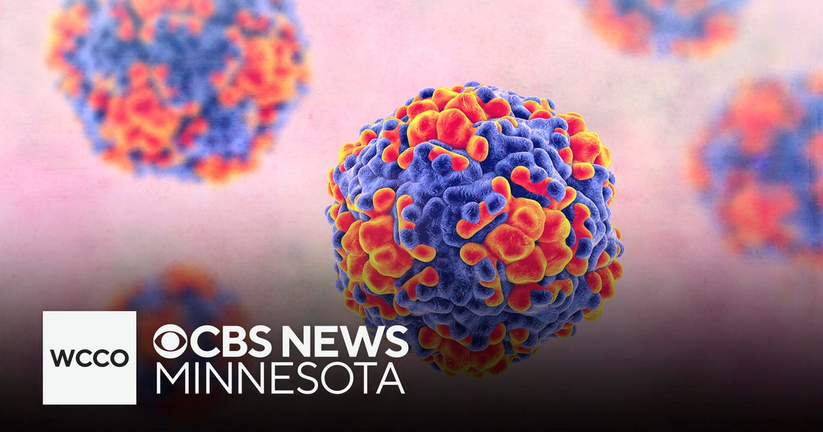 Tips on avoiding norovirus during your holiday gatherings - CBS Minnesota