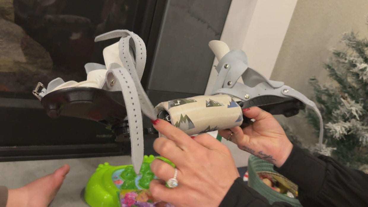 Colorado family whose son was born with clubfoot raising awareness ...