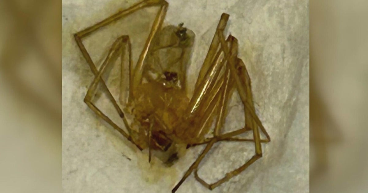 Florida woman says repeated spider bites inside her apartment led to ...