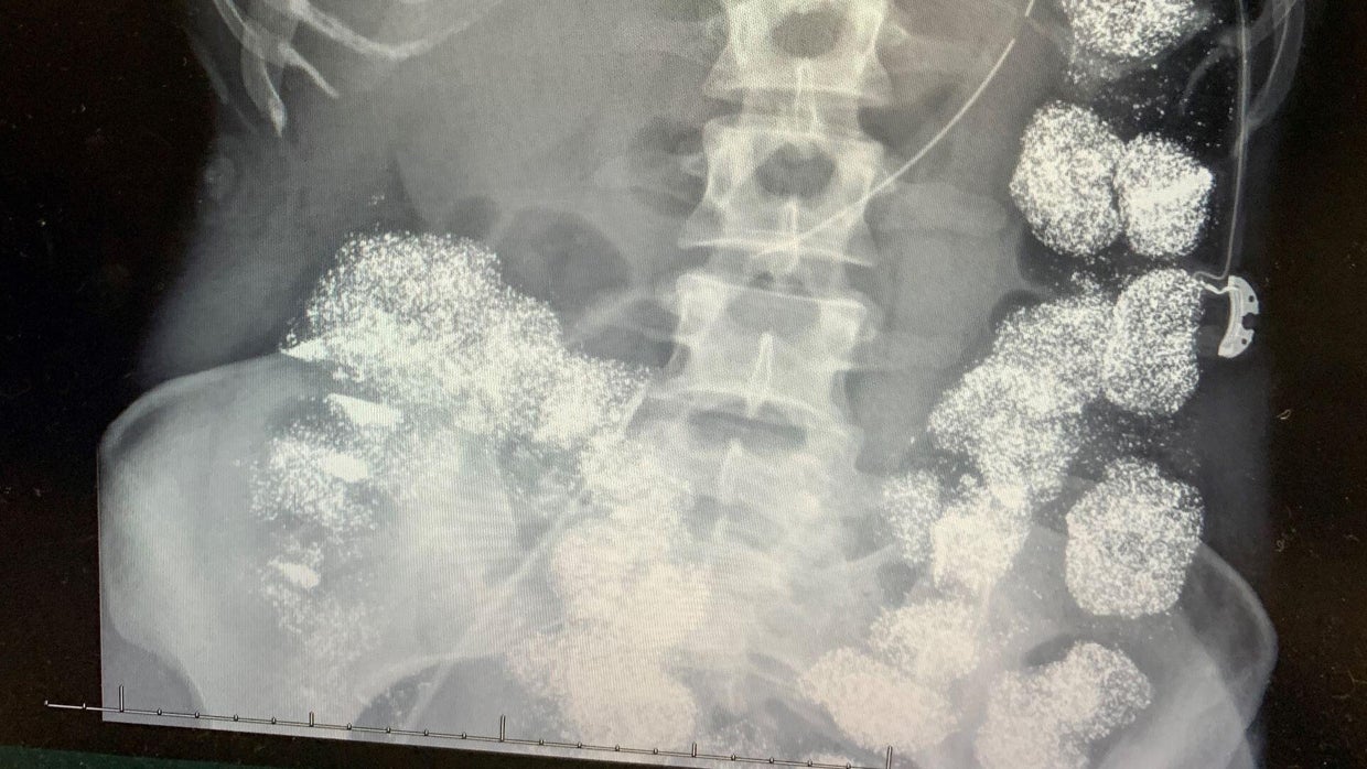 An Alabama mom was near death from lead poisoning. Who was trying to ...