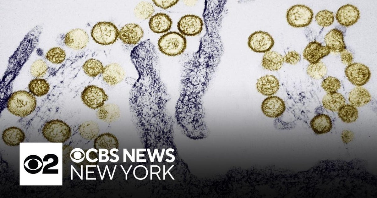 Global health officials tracking hantavirus after 3 deaths on cruise ...